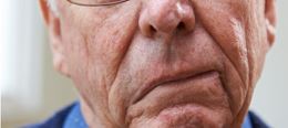 Survey 1 In 3 Adults May Have Had Warning Stroke But Most Didn t Seek 