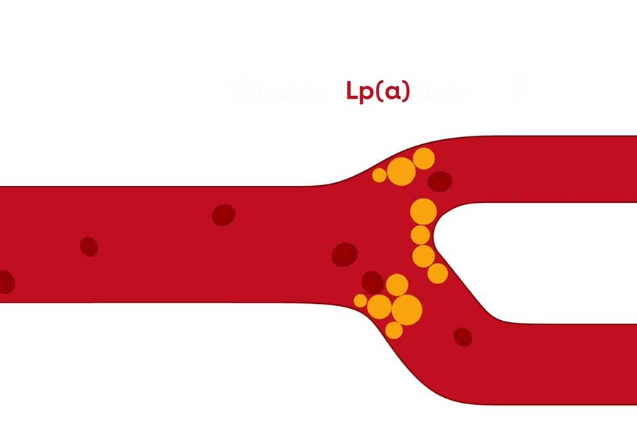Lipoprotein (a) | American Heart Association