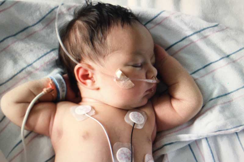 About Congenital Heart Defects | American Heart Association