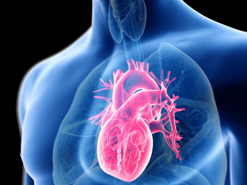 Deadly heart problem might not be so deadly | American Heart Association