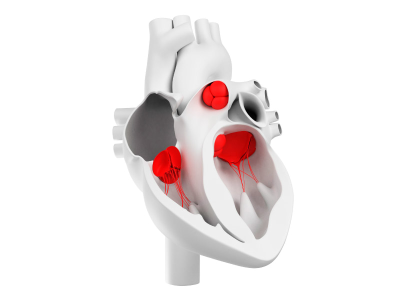 New guidelines call for less use of surgery to treat heart valve ...