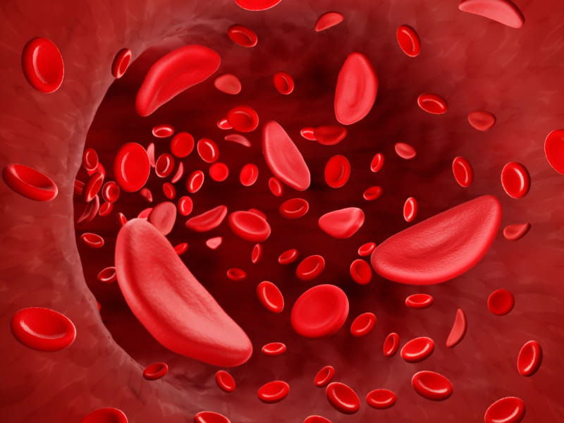 Bone marrow transplant may protect blood vessels in the brains of ...