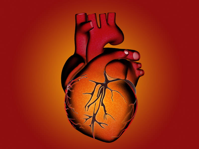 What is a heart attack? Cardiologists explain the condition following ...