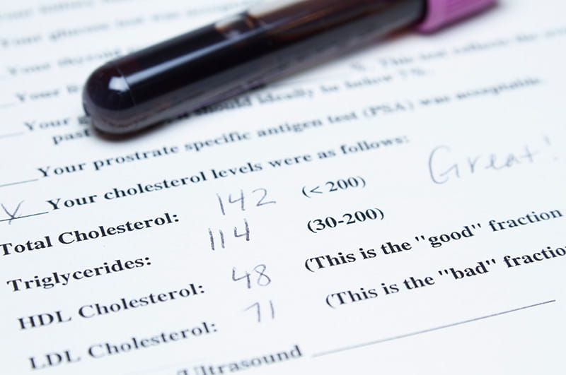 Ignore cholesterol until middle age? Here’s why that’s a bad idea ...