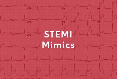 Montana Mission: Lifeline® STEMI | American Heart Association