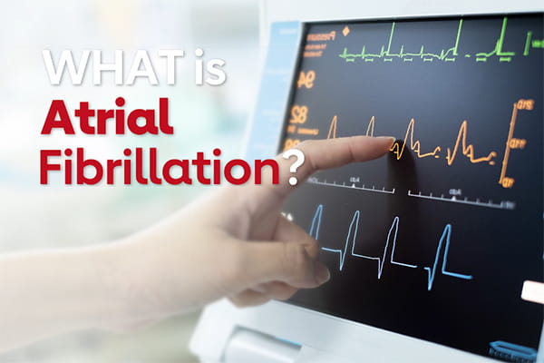 What the scientific guidelines say about atrial fibrillation | American ...