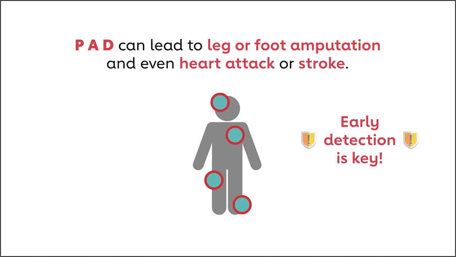 PAD Questions to Ask Your Doctor | American Heart Association
