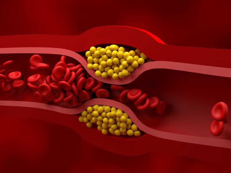 American Heart Association News brings you the latest information about ...