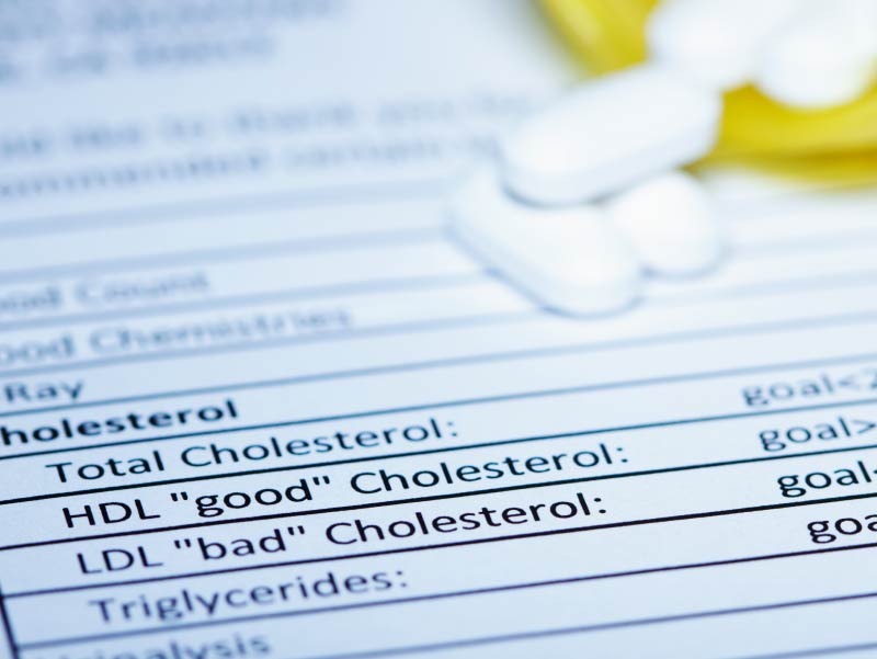 New guidelines: Cholesterol should be on everyone's radar, beginning ...