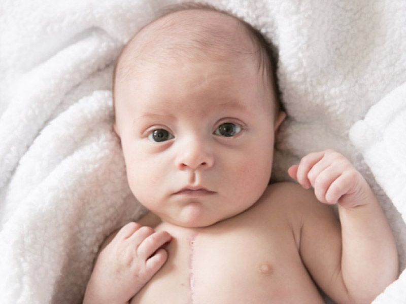 Two heart operations in her first 8 months of life | American Heart ...